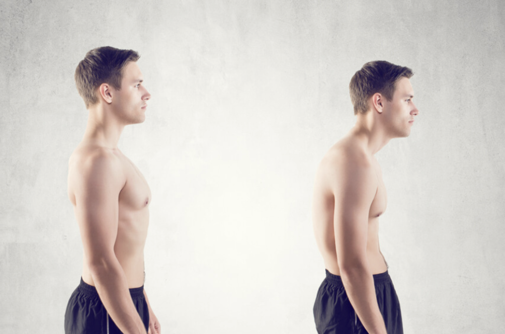 Mewing Neck Posture Improve Your Neck Posture And Relieve Neck Pain